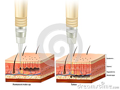 Difference Between Tattoo And Permanent Make-up Process. Pigment Under ...