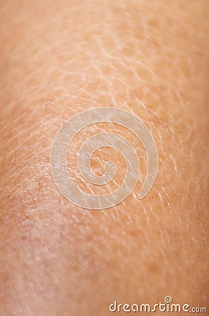 Dry And Cracked Skin Textures Close Up Stock Photo - Image: 22629560