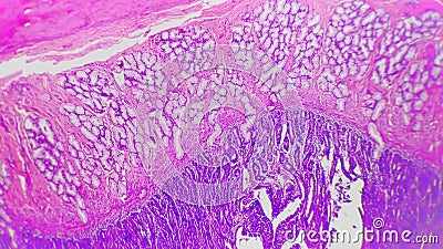 Duodenum of the Human Being in Section Shown Under Microscope with 40x ...