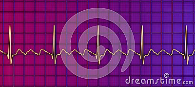 ECG In Atrial Flutter, 3D Illustration Royalty-Free Cartoon ...