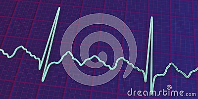 ECG In Atrial Flutter, 3D Illustration Royalty-Free Cartoon ...