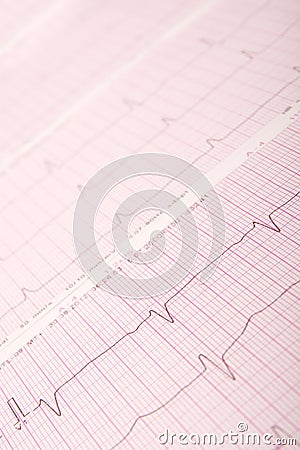 ECG Chart (ECG Results) Stock Image | CartoonDealer.com #27028309