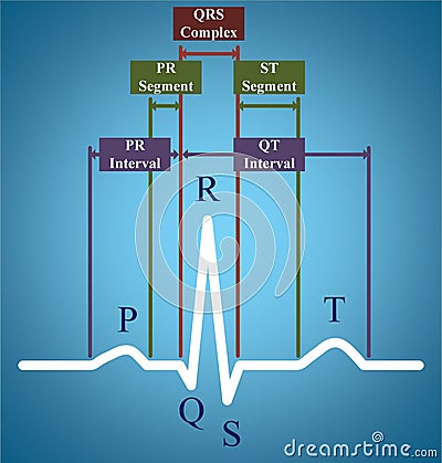 ECG Or Electrocardiogram Showing QRS Complex Stock Photography ...