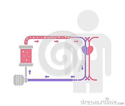 ECMO Extracorporeal Membrane Oxygenation Structure Vector Illustration ...