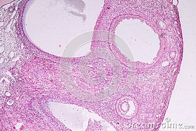 Histological Sample Ovary Of Rabbit Tissue Under The Microscope ...