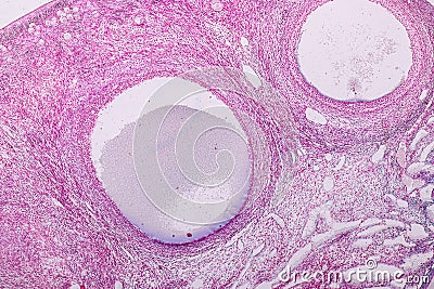 Histological Sample Ovary Of Rabbit Tissue Under The Microscope ...