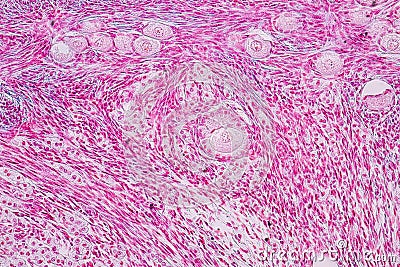 Histological Sample Ovary Of Rabbit Tissue Under The Microscope ...