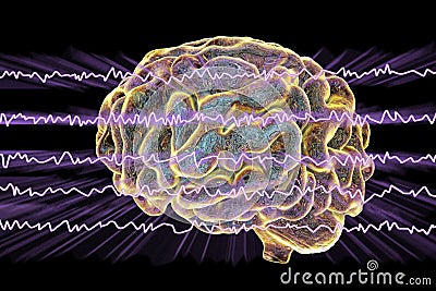 EEG Electroencephalogram, Brain Wave In Awake State With Mental ...