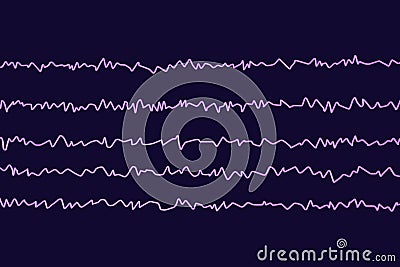 EEG Electroencephalogram, Brain Wave In Awake State With Mental ...