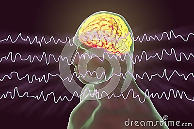 EEG Electroencephalogram, Brain Wave In Awake State During Rest Royalty ...