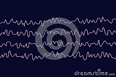 EEG Electroencephalogram, Brain Wave In Awake State During Rest Stock ...