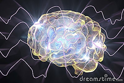 EEG Electroencephalogram, Brain Wave In Deep Sleep Royalty-Free ...