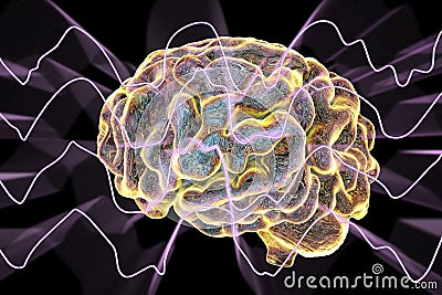 EEG Electroencephalogram, Brain Wave In Deep Sleep Royalty-Free Cartoon ...