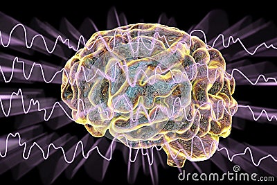 EEG Electroencephalogram, Brain Wave During Sleeping Stock Illustration ...