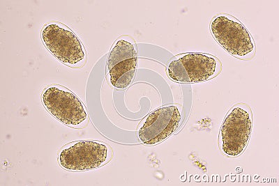 Eggs of Hookworm in stool stock photo. Image of experiment - 143060376