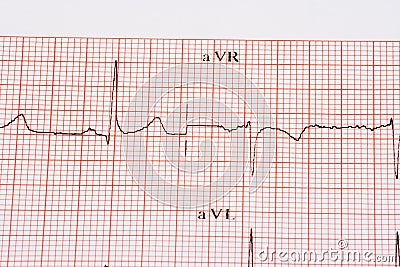 EKG Chart Stock Image - Image: 3638031