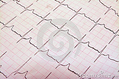 Ekg Stock Photo - Image: 50867571