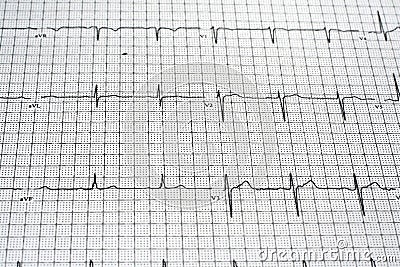 EKG Readout Stock Photography | CartoonDealer.com #4081106