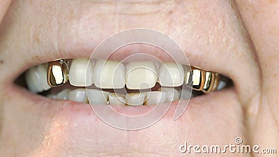 Smiling Mouth of Old Woman with False Teeth Stock Footage - Video of ...