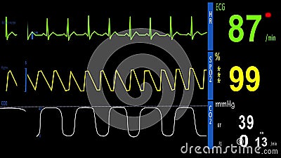 Electrocardiogram, ECG, Hartmonitor Stock Footage - Video of hartslag ...