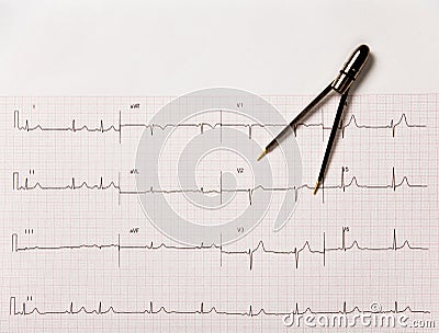 Electrocardiogram, Or EKG, With Calipers Stock Photos - Image: 4599023