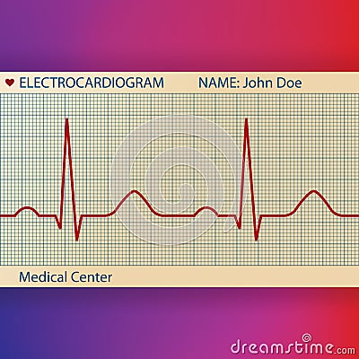 Electrocardiogram Paper With Normal ECG Cartoon Vector | CartoonDealer ...