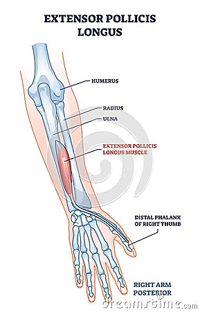 Extensor Pollicis Longus Muscle Location With Arm Skeleton Outline ...
