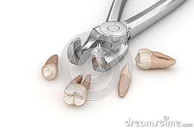 Extraction Forceps And Teeth, Concept 3D Illustration Royalty-Free ...