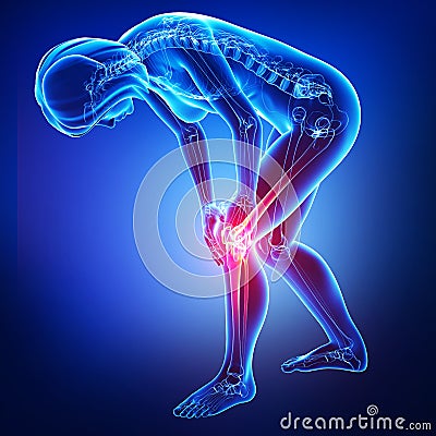 Female Knee And Joints Pain In Blue Royalty Free Stock Photo - Image ...