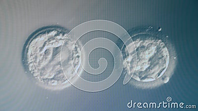 Fertilized Egg Cells are Being Analyzed Under a Microscope Stock ...