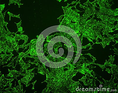 Fluorescence Microscopy Image With Cells Stained In Fluorescent Green ...