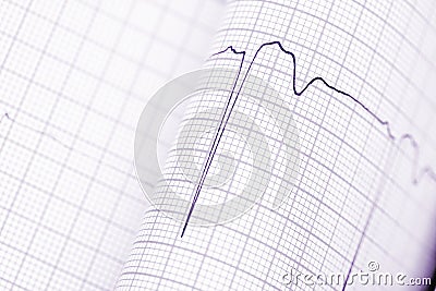 Folded Graph Paper With ECG Royalty-Free Stock Image | CartoonDealer ...
