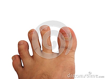 Foot Without Toe Nail Stock Image - Image: 25069741