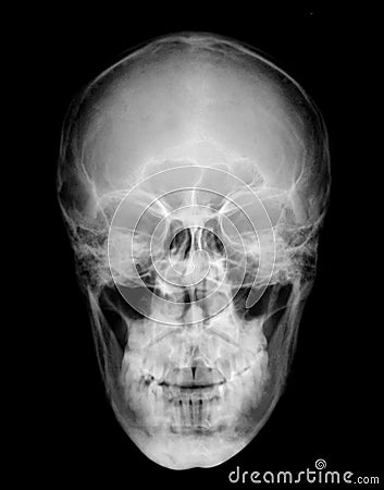 Xray/Face side stock image. Image of health, disease, diagnosis - 198831