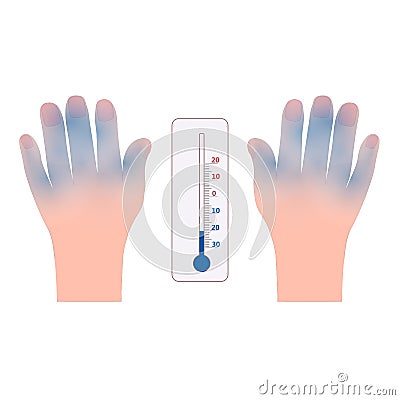 Frostbite Hands And Thermometer Icon Vector | CartoonDealer.com #178520413