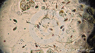 Alternaria Mold Under the Microscope Stock Video - Video of shaped ...