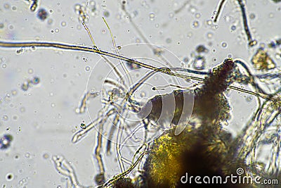 Fungal Hyphae Under The Microscope Royalty-Free Stock Photography ...