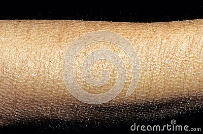 14,342 Skin Flesh Photos - Free & Royalty-Free Stock Photos from Dreamstime