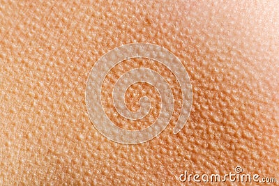 Goosebumps Skin Background Stock Photography - Image: 6112842