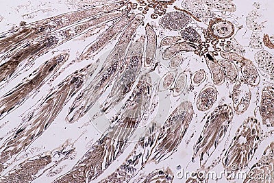 Grasshopper Testis Under The Microscope In Lab. Royalty-Free Stock ...