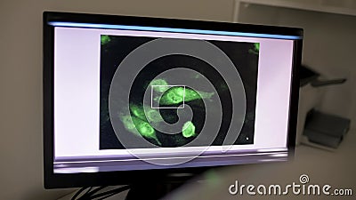 Green Molecules of a Virus or Bacteria Under a Modern Electron ...