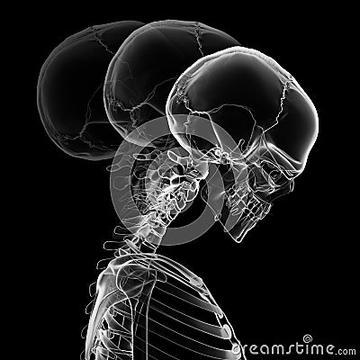 Guy Bending His Neck Royalty-Free Cartoon | CartoonDealer.com #34775963