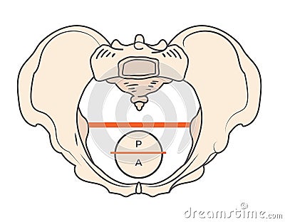 Gynecoid Pelvis Shape With Round / Circular Shape Vector Illustration ...