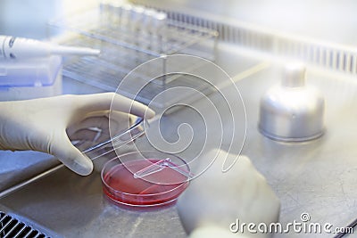 Hands Of Scientists Are Working On Research.Bacteria In Agar Sheets ...