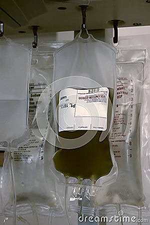 Hanging Bag Of Platelets From Blood Donation Stock Photo - Image: 1808680