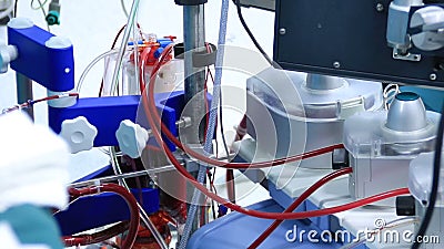 Hart-long Machine Voor Hartchirurgie Stock Video - Video of beroep ...