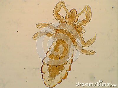 Head Louse Pediculus Humanus Capitis Under Microscope Stock Photo ...