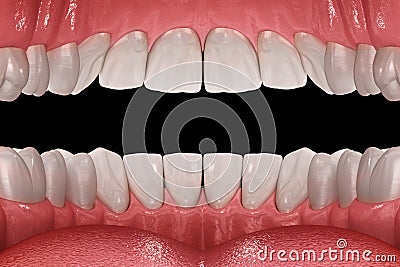 Healthy Human Teeth With Normal Occlusion, View Form Inside. Medically ...