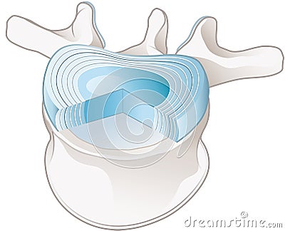 Healthy Lumbar Vertebrae And Intervertebral Disc. Labeled Illustration ...
