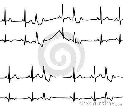 Heart Diseases Graphs Royalty-Free Stock Photography | CartoonDealer ...